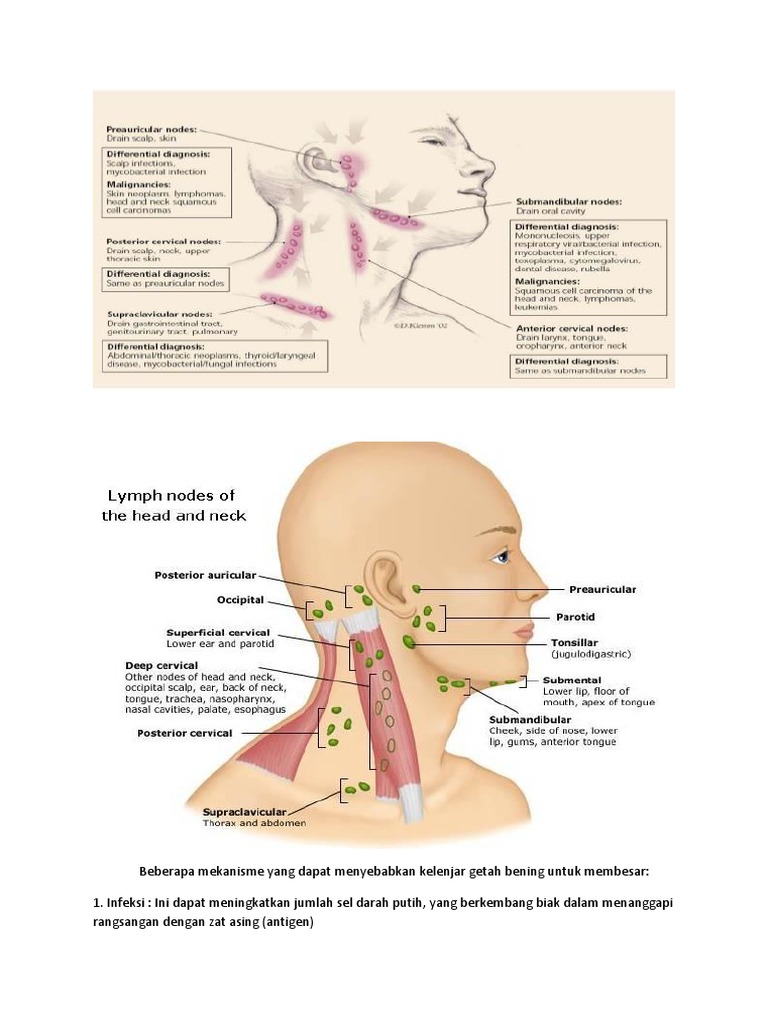 Kelenjar Limfa | PDF