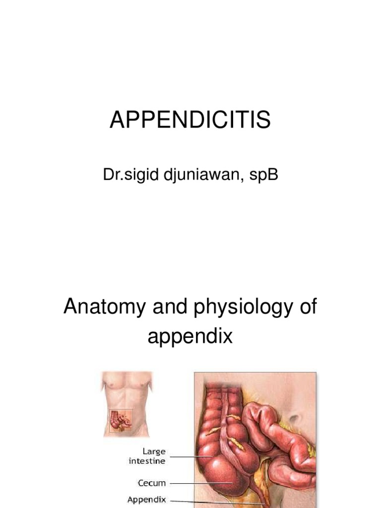Appendicitis: DR - Sigid Djuniawan, SPB | Download Free PDF | Digestive Diseases | Epidemiology