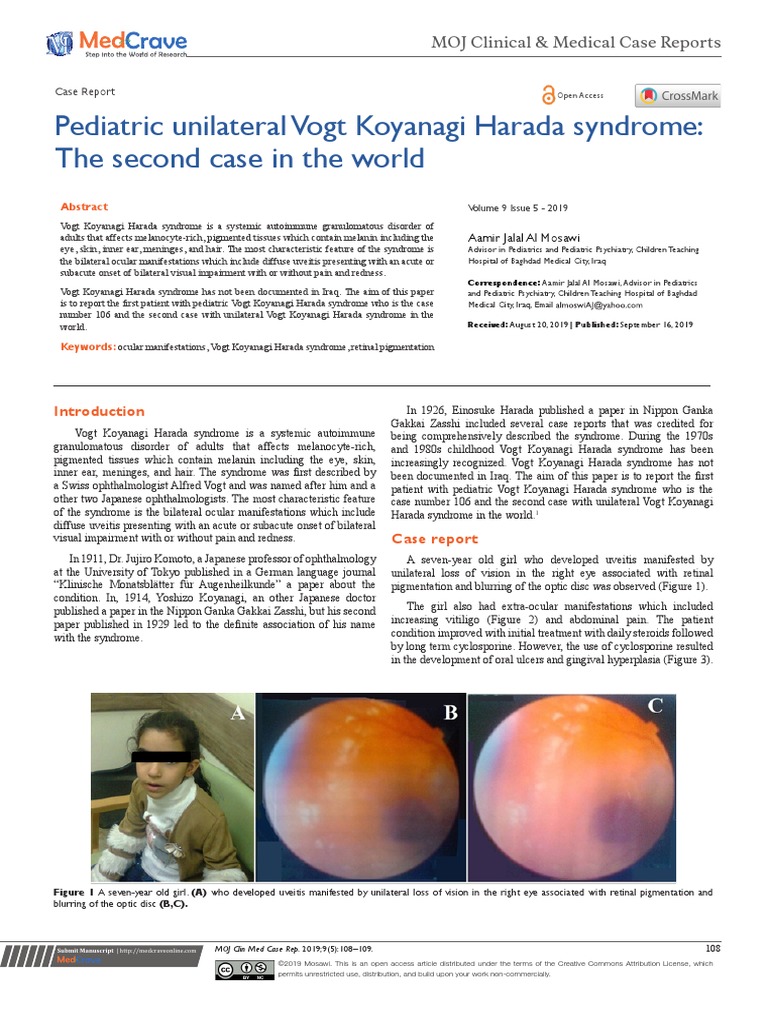 Pediatric Unilateral Vogt Koyanagi Harada Syndrome: The Second Case in ...