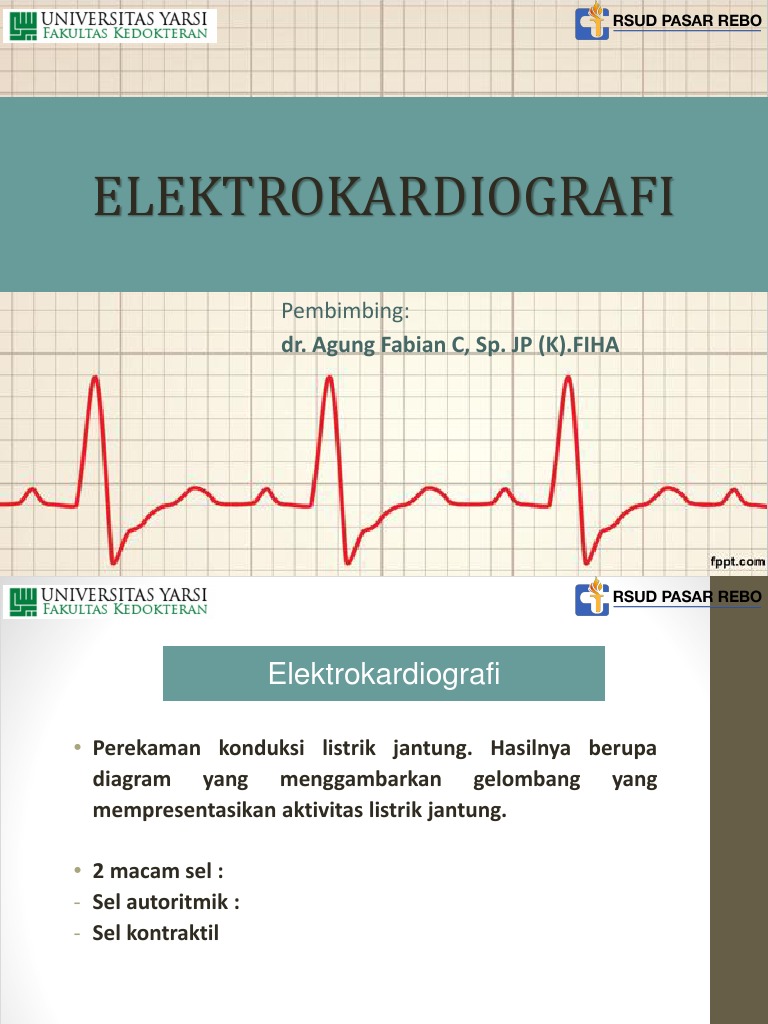 EKG Presentasi Dr. Agung Fabian C, SP - JP (INTERNA REBO) | PDF