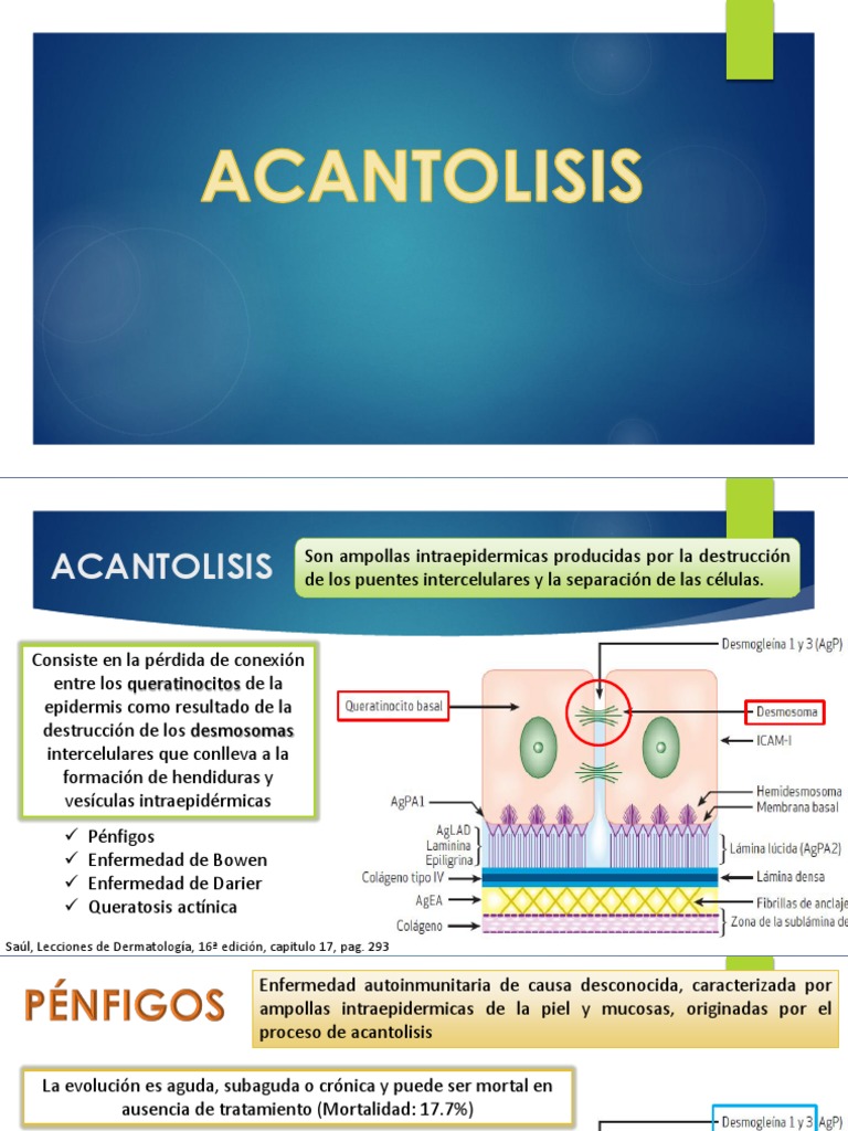 ACANTOLISIS | PDF