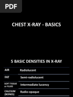 Chest X-Ray Interpretation | PDF