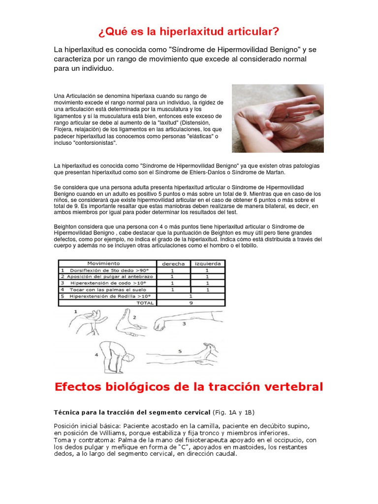 Hiperlaxitud Articular | PDF | La columna vertebral | Sistema ...