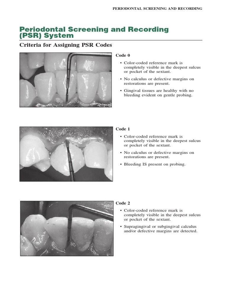 Periodontal Screening and Recording (PSR) System: Criteria For ...