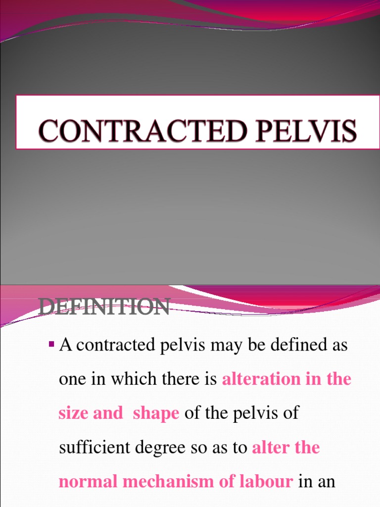 Managing Cephalopelvic Disproportion: An Overview of Contracted Pelvis ...