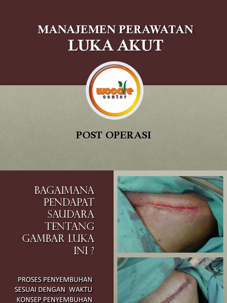 Luka Akut | PDF
