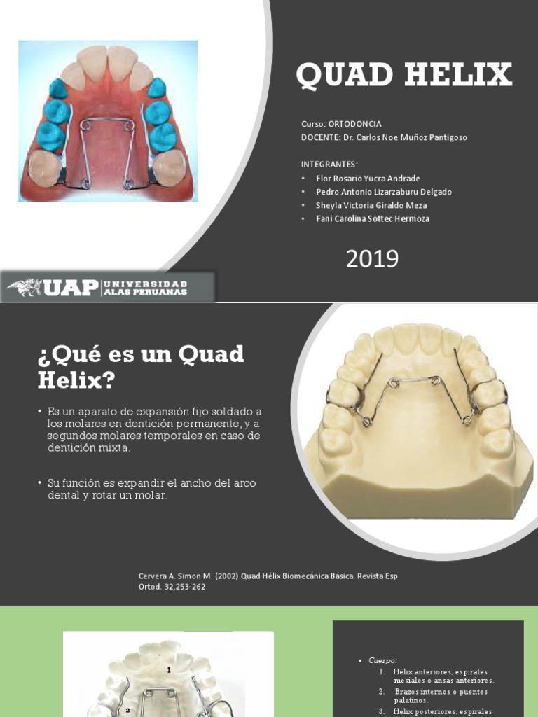 Quad Helix (Caso Clinico) | PDF | Odontología | Boca