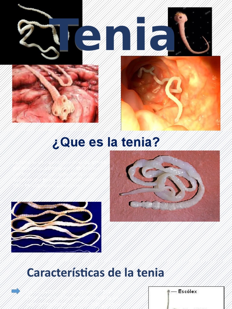 Tenia | PDF | Enfermedades y trastornos | Medicina CLINICA