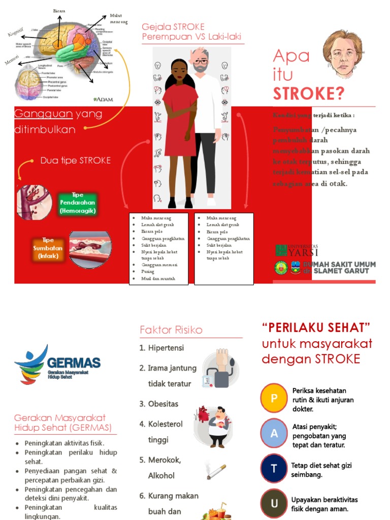 Brosur Stroke | PDF