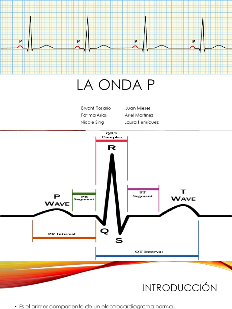 La Onda P | PDF | Electrocardiografia | Corazón