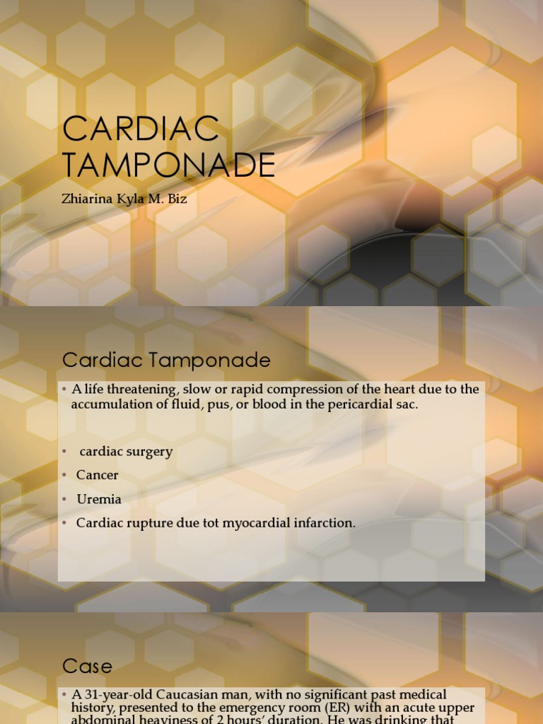 Cardiac Tamponade: Zhiarina Kyla M. Biz | PDF | Thorax (Human Anatomy ...