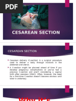 Normal Delivery Instrument Sets | PDF | Uterus | Surgical Suture