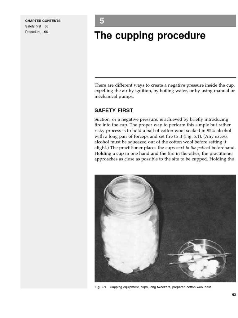 Cupping Procedure: Safety and Techniques | PDF | Medicine | Clinical ...