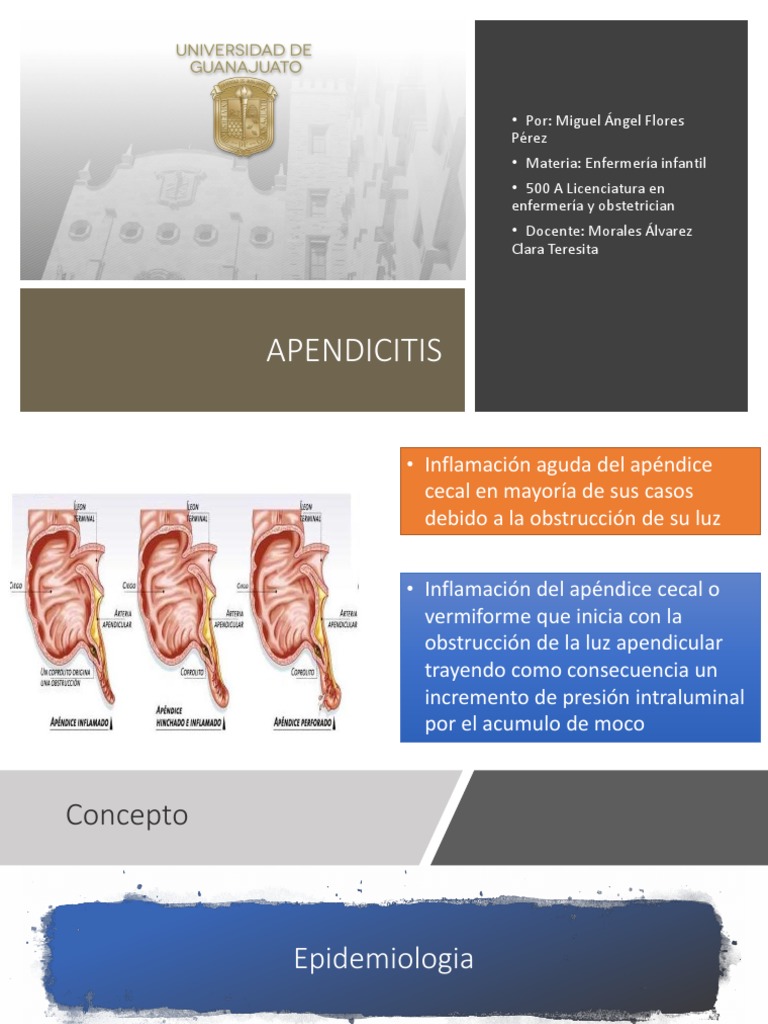 Apendicitis | Epidemiología | Inmunología