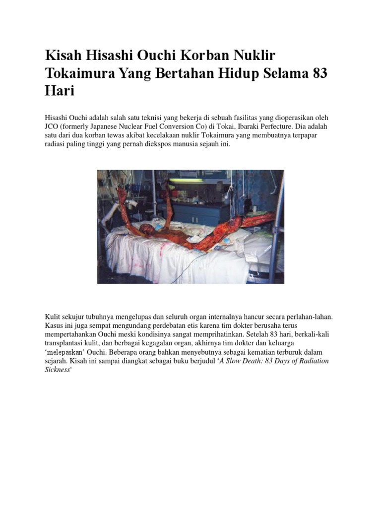 Kisah Hisashi Ouchi Korban Nuklir Tokaimura Yang Bertahan Hidup Selama ...