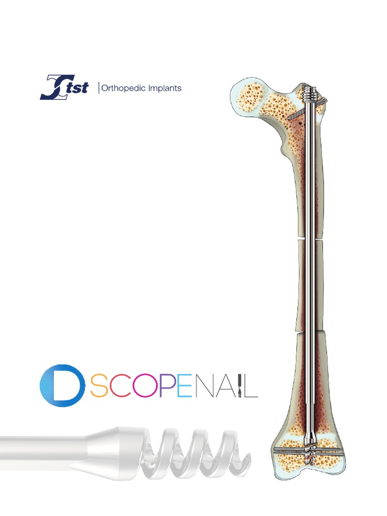 Telescopic Nail for Osteogenesis Imperfecta | PDF | Screw | Drilling
