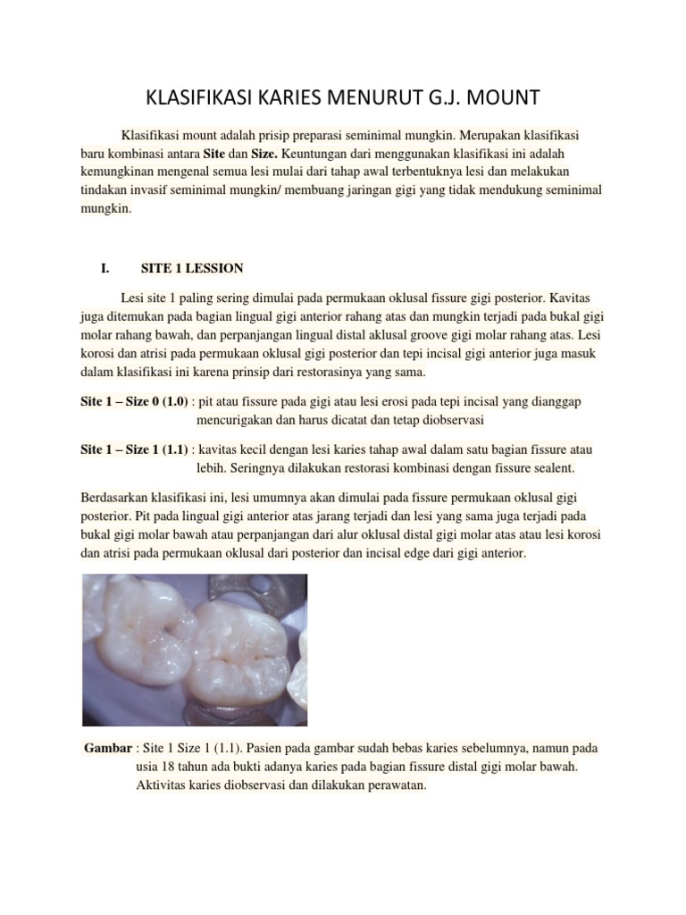 Klasifikasi Karies G J Mount | PDF