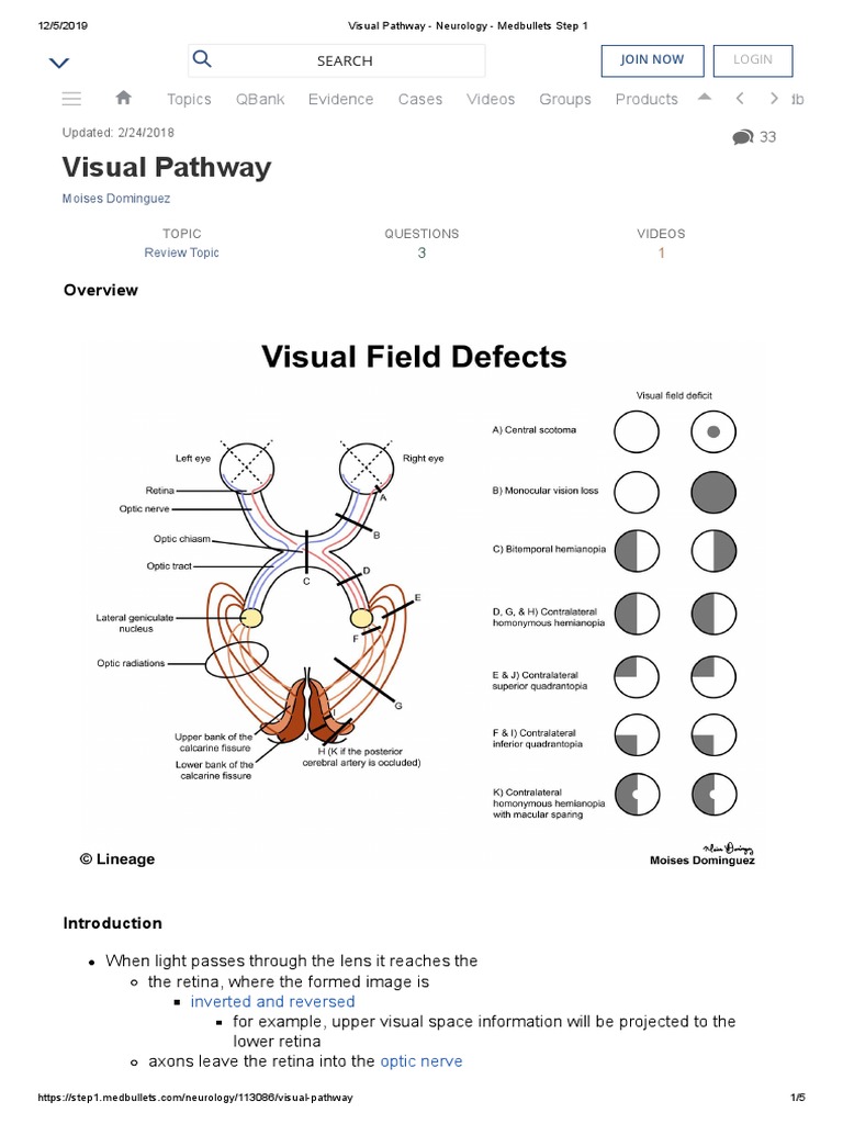 Visual Pathway - Neurology - Medbullets Step 1 | Visual System | Senses