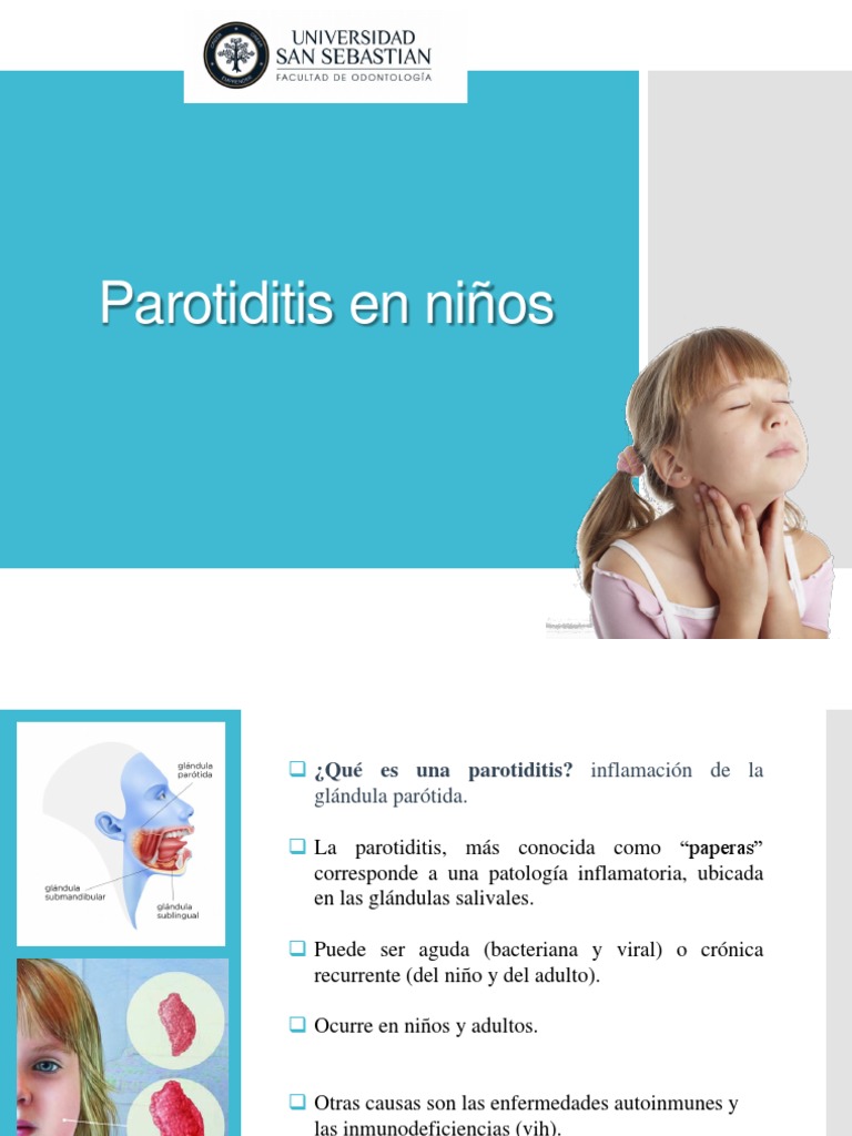 Parotiditis en Niños | PDF | Especialidades Medicas | Enfermedades y ...