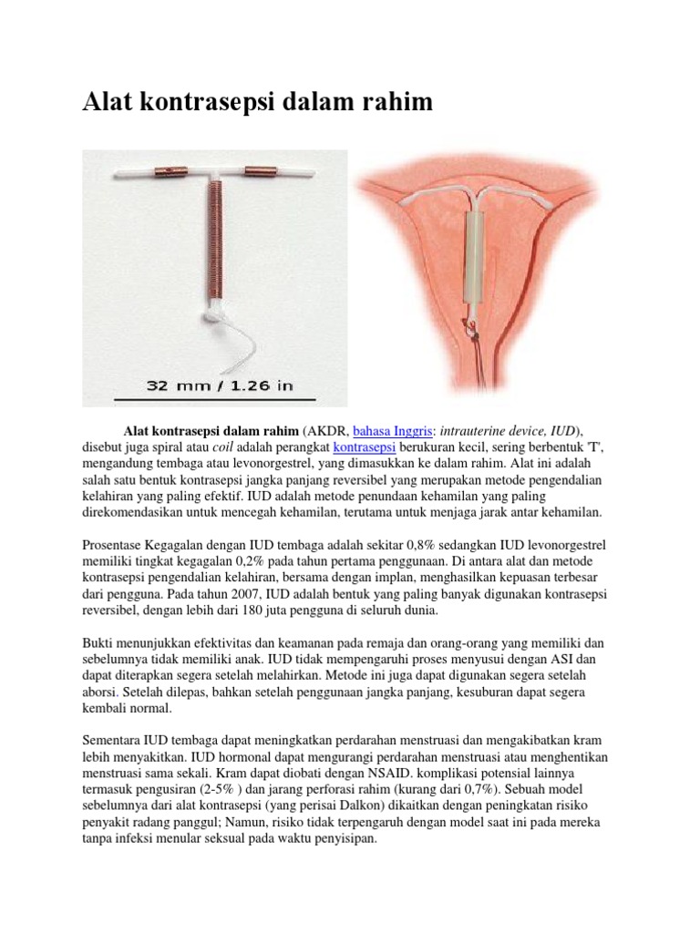 Alat Kontrasepsi Dalam Rahim | PDF