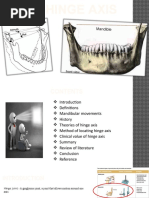 Loading Protocols in Implants | PDF | Dental Implant | Bone