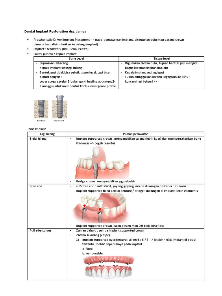 Panduan Restorasi Implan Gigi | PDF | Sains & Matematika