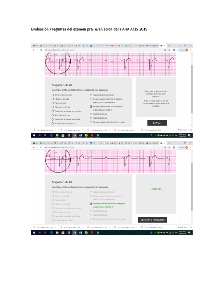 Pre-Evaluacion SVCA ACLS AHA 2015 Con Los Trazados Del EKG y Respuestas ...