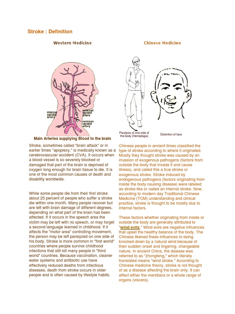 Stroke: Definition: Western Medicine | PDF | Stroke | Traditional ...