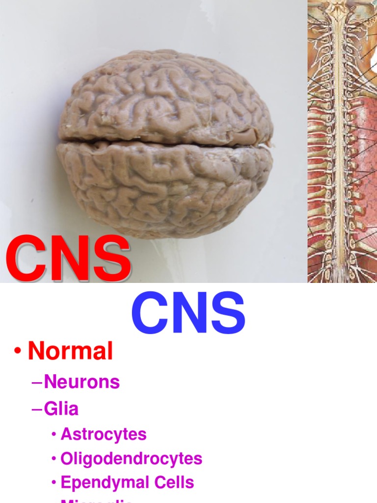An Overview of Central Nervous System Pathology: Cellular Reactions ...