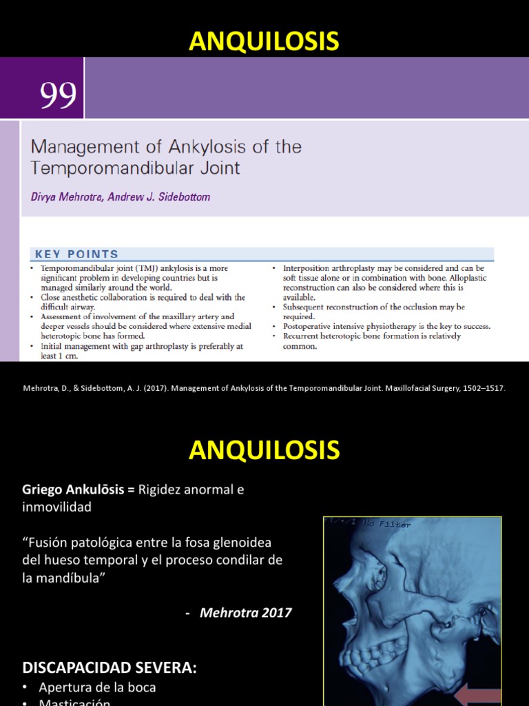 Anquilosis Atm | PDF | Articulación | Hueso