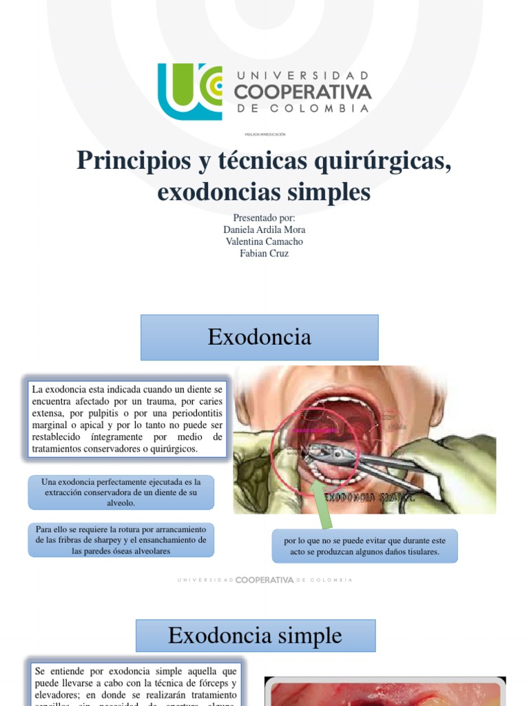 Exodoncia Simple | Especialidades Medicas | Medicina CLINICA
