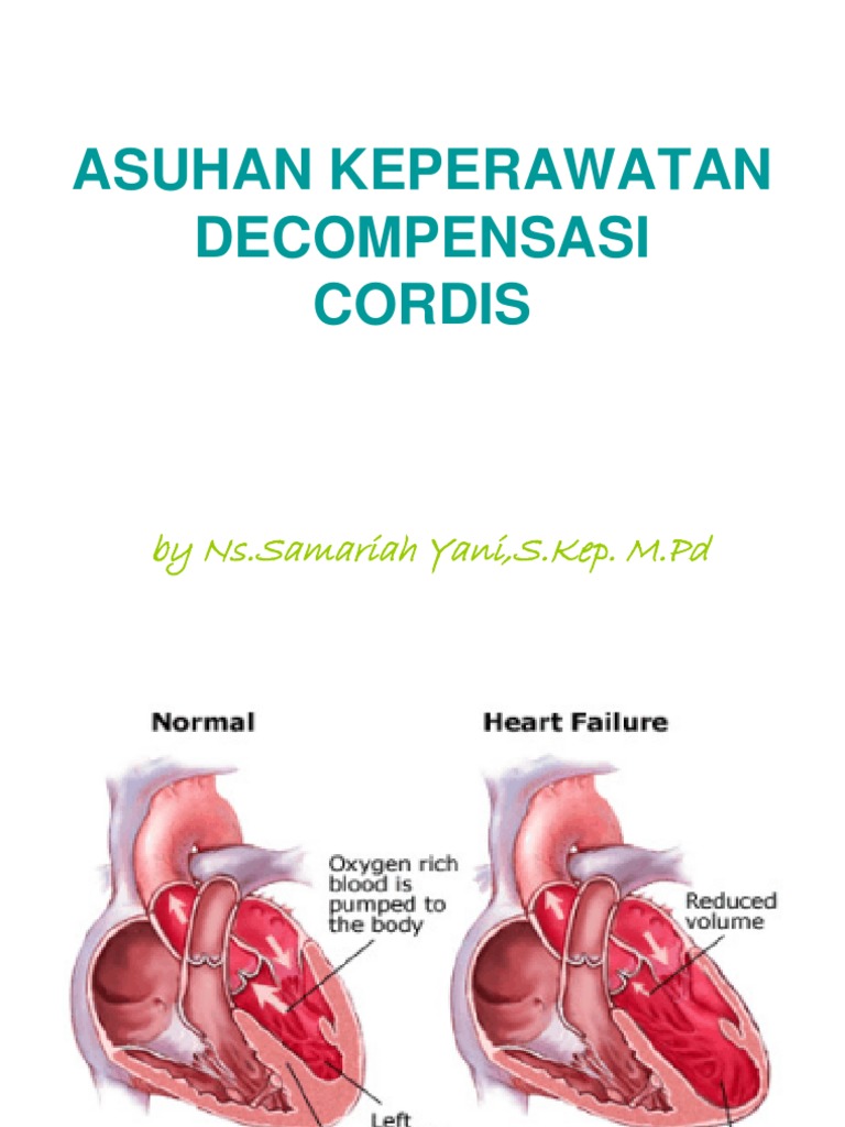 Decomp Cordis | PDF