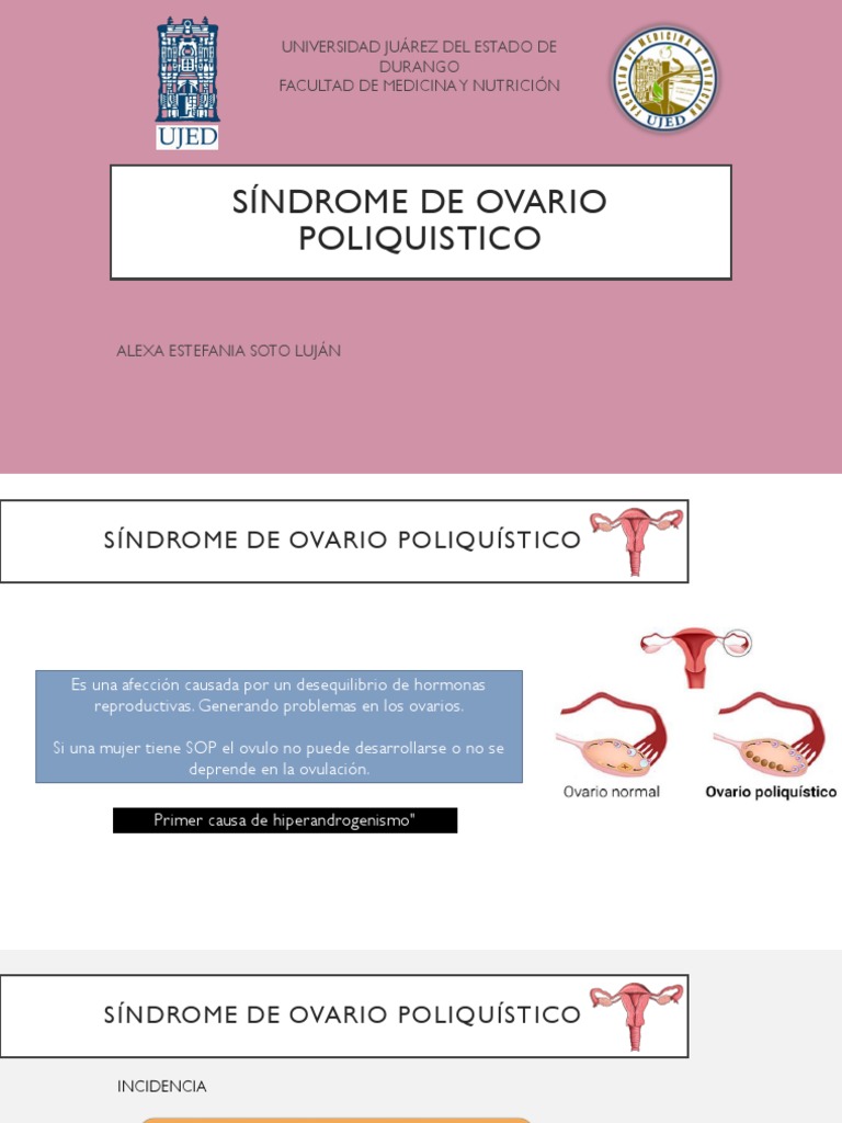 Síndrome de Ovario Poliquístico: Causas y Tratamiento | PDF | Sindrome ...
