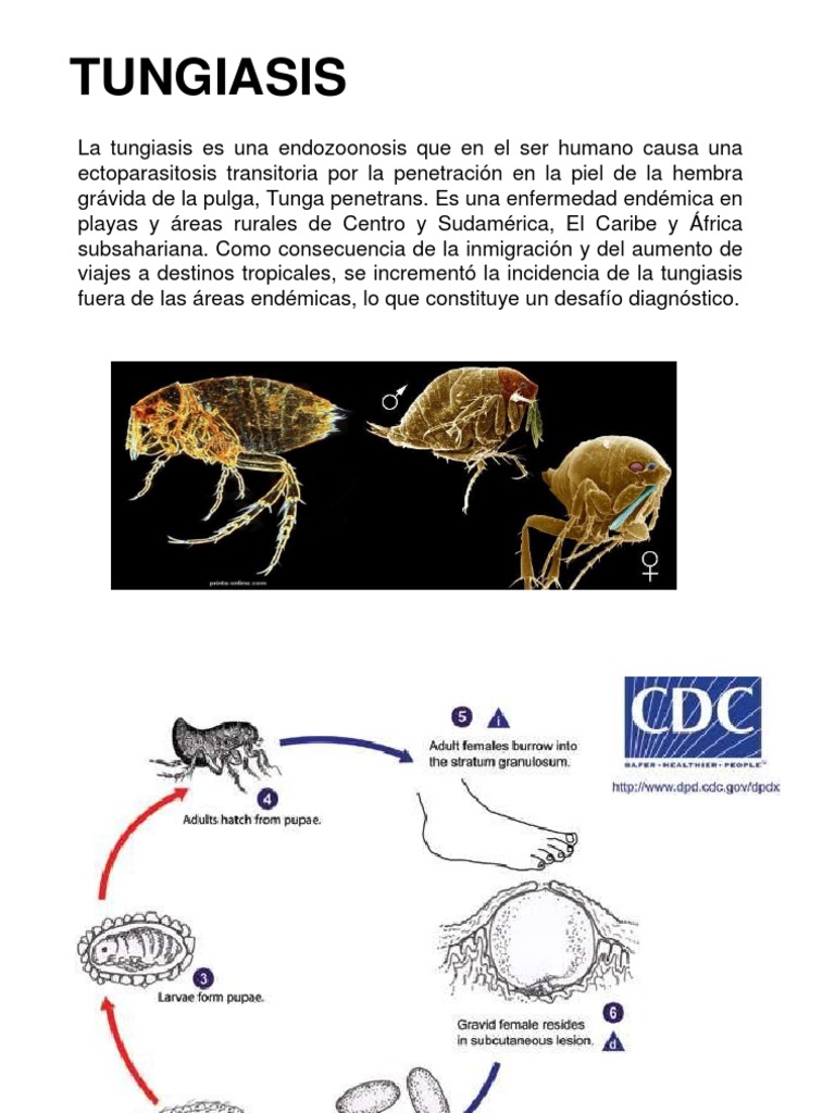 Tratamiento y ciclo de vida de tungiasis | PDF | Especialidades Medicas ...
