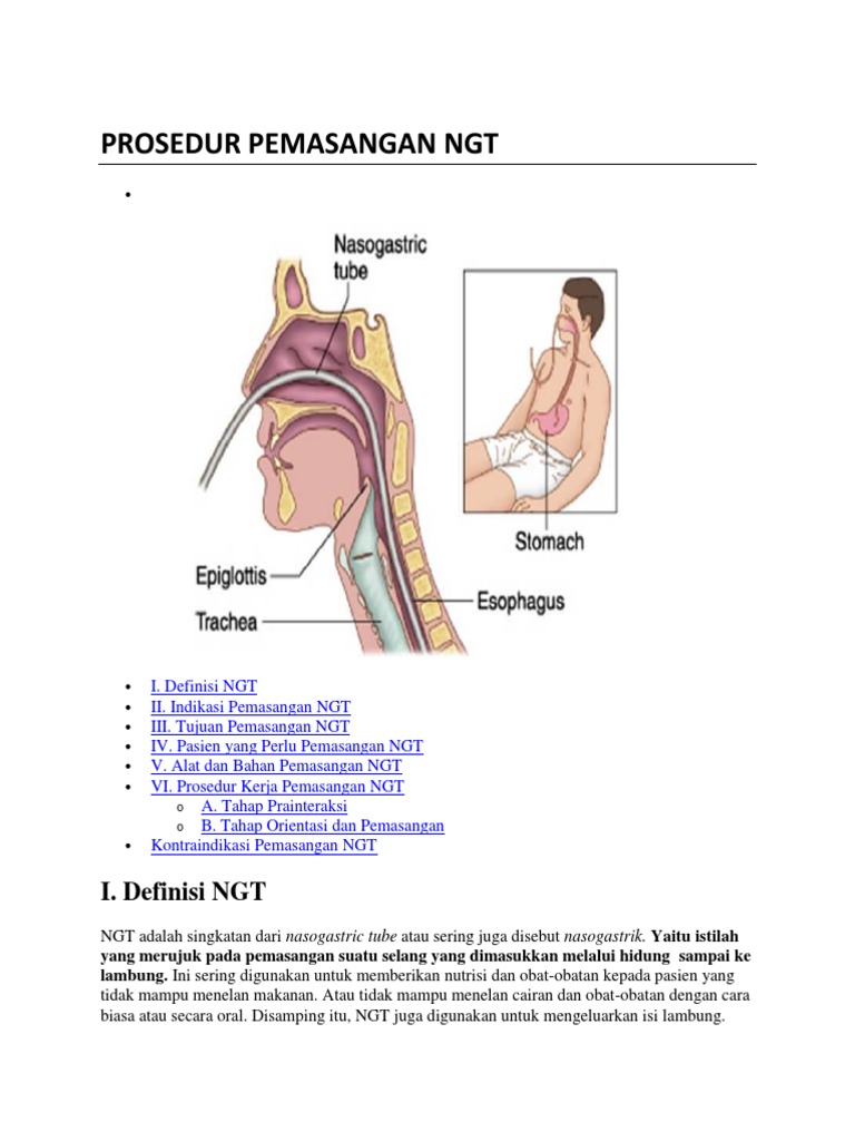 Prosedur Pemasangan NGT | PDF