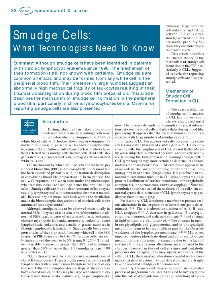 Smudge Cells:: What Technologists Need To Know | PDF | White Blood Cell ...