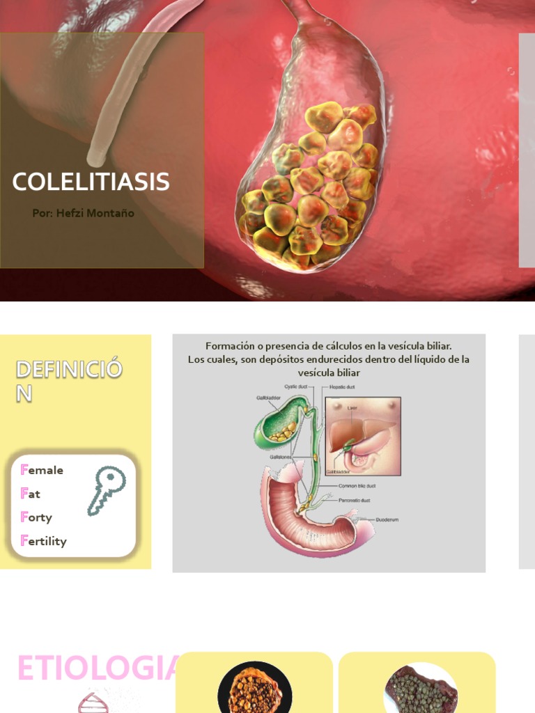 Semiología de La Colelitiasis | PDF