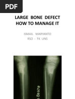 Emra Sportsmedicine Splint Guide PDF | PDF | Thumb | Hand