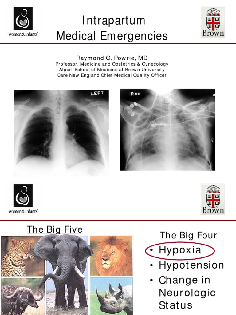 B11..Intrapartum Emergencies Singapore PDF | PDF | Pneumonia | Asthma