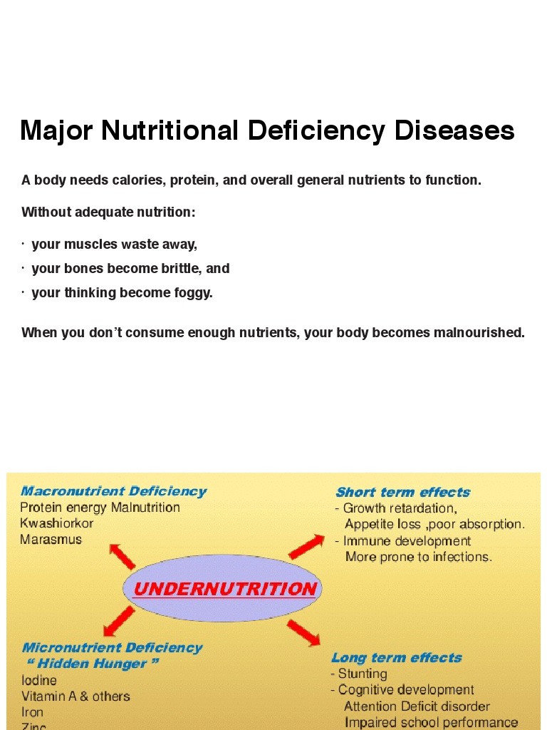 Major Nutritional Deficiency Diseases | PDF | Malnutrition | Hypothyroidism