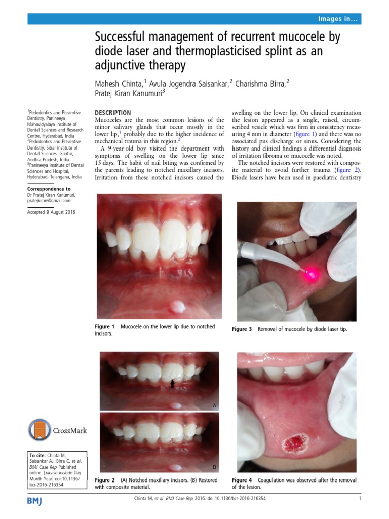 Mukokel | PDF | Medical Specialties | Clinical Medicine