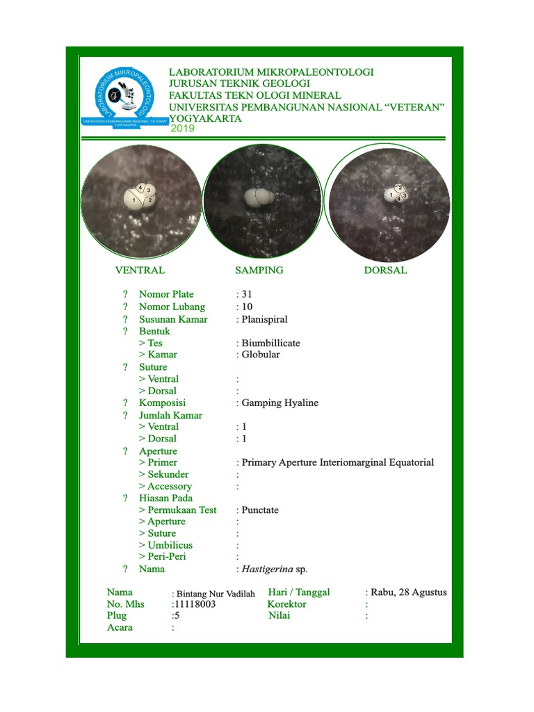 Hastigerina Dan Globorotalia G | PDF