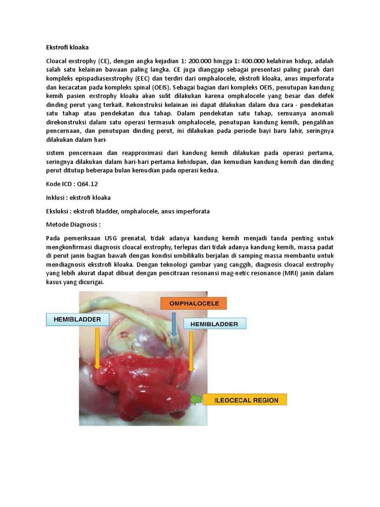 Ekstrofi Kloaka: Diagnosis dan Rekonstruksi | PDF