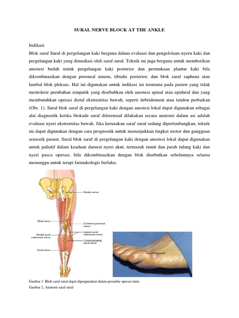 ANKLE (Sural Nerve Block) | PDF