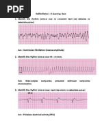 ECG EKG Examples and Quiz | PDF | Electrocardiography | Cardiac ...
