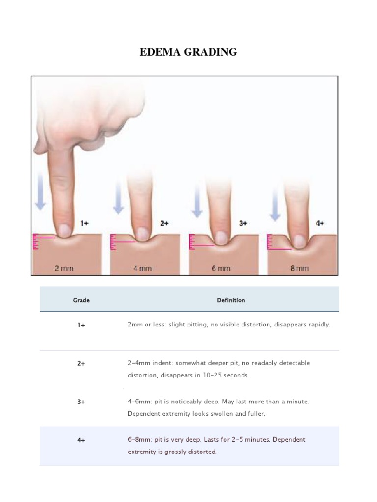 Edema Grading Scale Explained | PDF