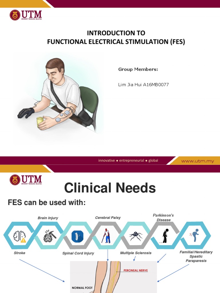 Introduction To Functional Electrical Stimulation | PDF | Cerebral ...