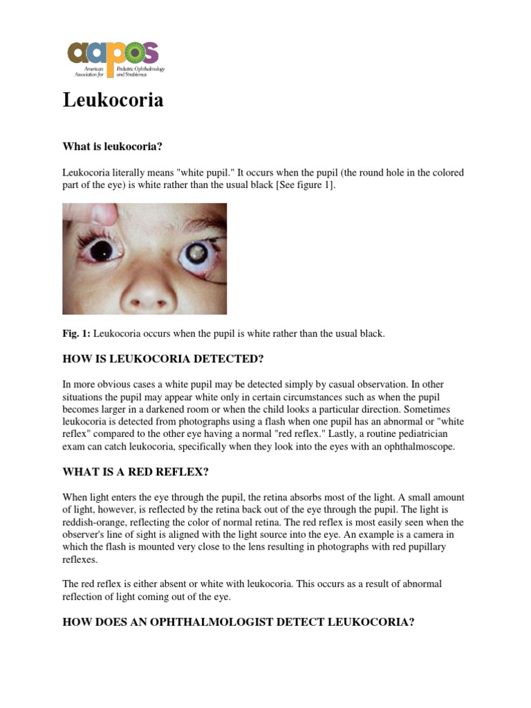 Leukocoria | PDF | Eye | Retina