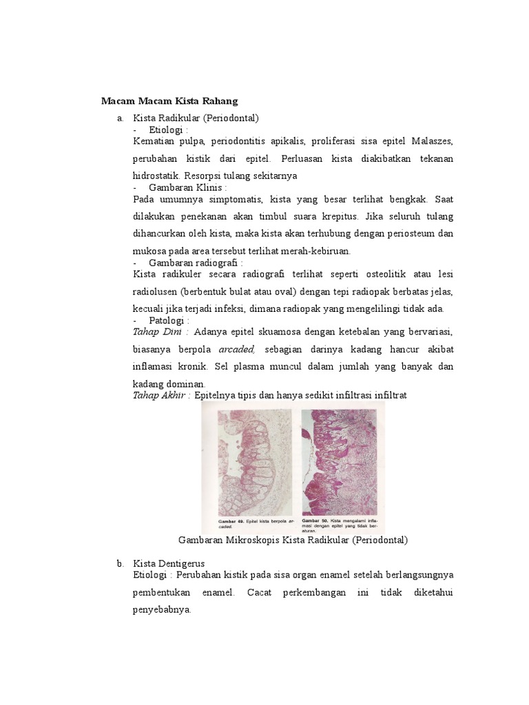 Jenis-jenis Kista Rahang dan Patologinya | PDF
