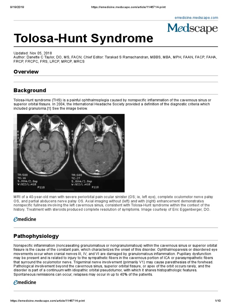Tolosa Hunt | PDF | Neurology | Medical Diagnosis